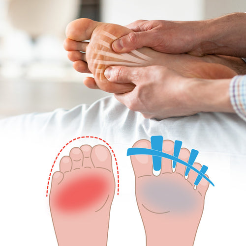 How Toe Separators Can Improve Foot Alignment and Balance